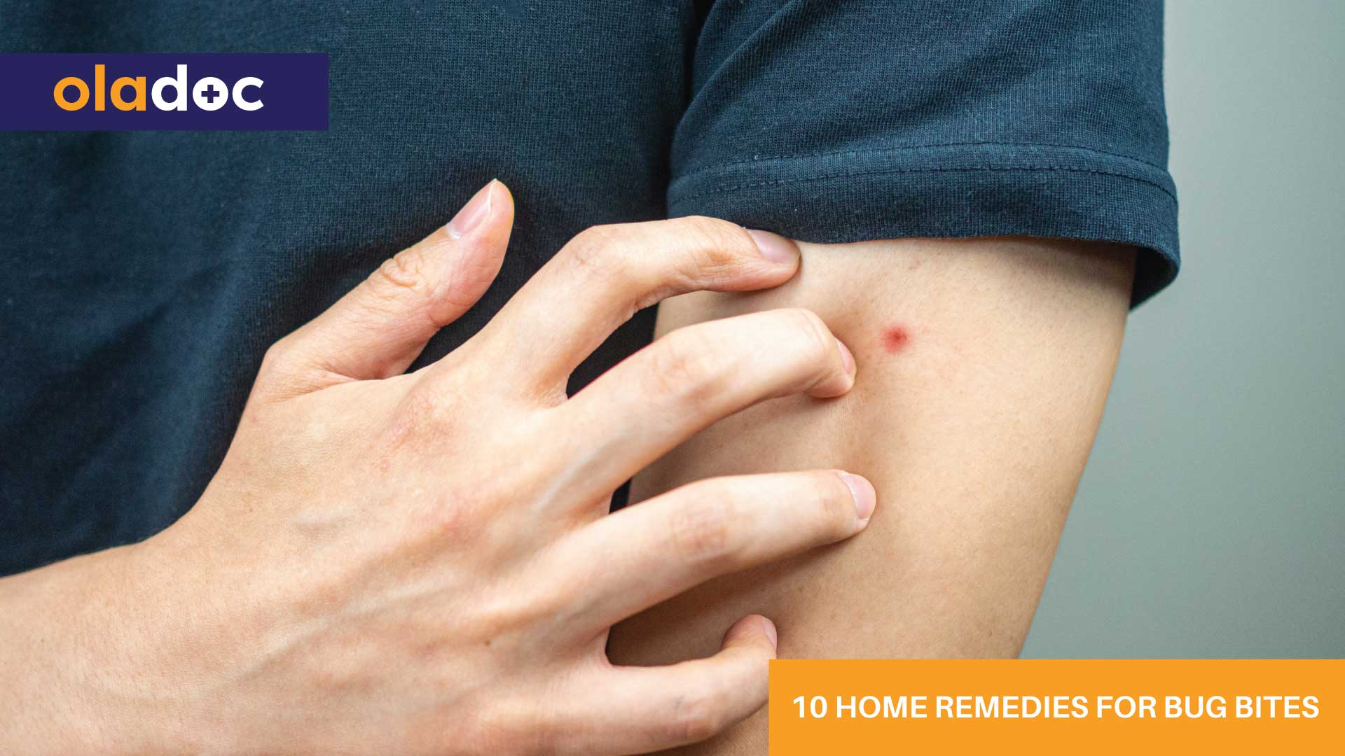 10 Home Remedies for Bug Bites | Home Remedies | oladoc.com