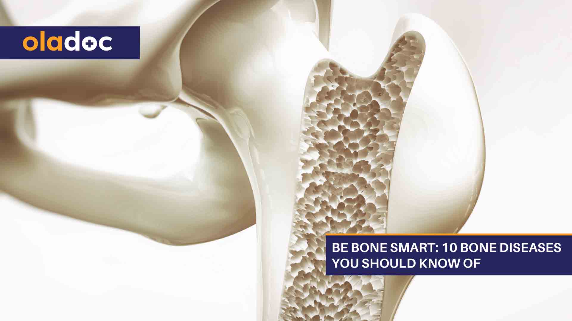 Be Bone Smart: 10 Bone Diseases You Should Know Of | Bones and Joints ...